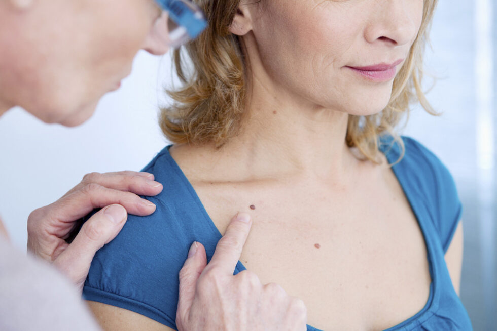 Skin Exam Reminders - North Pacific Dermatology | Dermatology